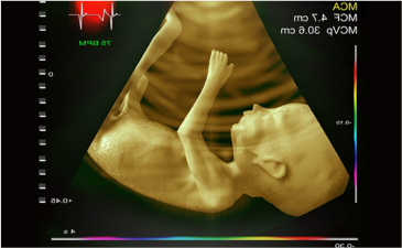 Ultrasound Scans - Racham Fetal Medicine
