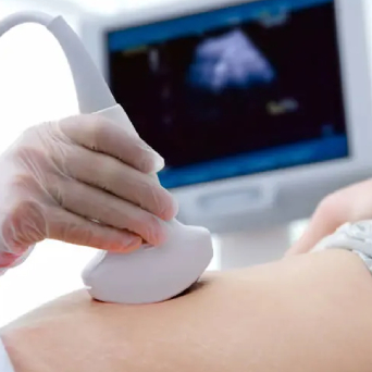 Amniocentesis - Racham Fetal Medicine
